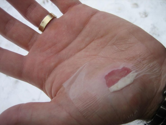 Skin Ripped Off | Play Four Square